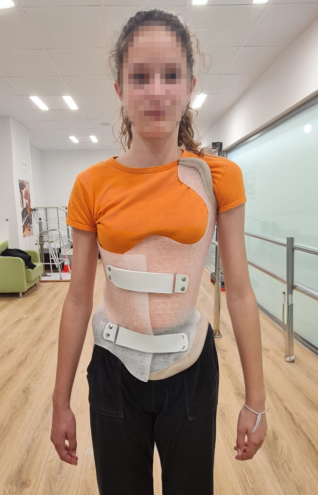 Tailored 3D printing solutions for orthopedics, prosthetics and other